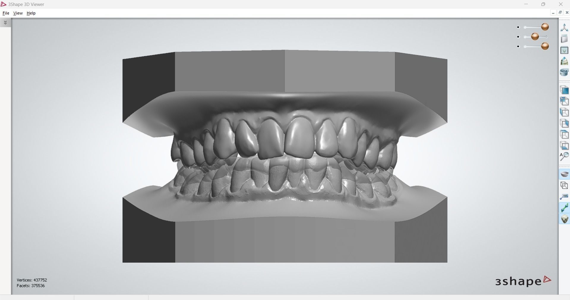 Digital Flat Occlusal Plane Splint 3D model 3D printable | CGTrader