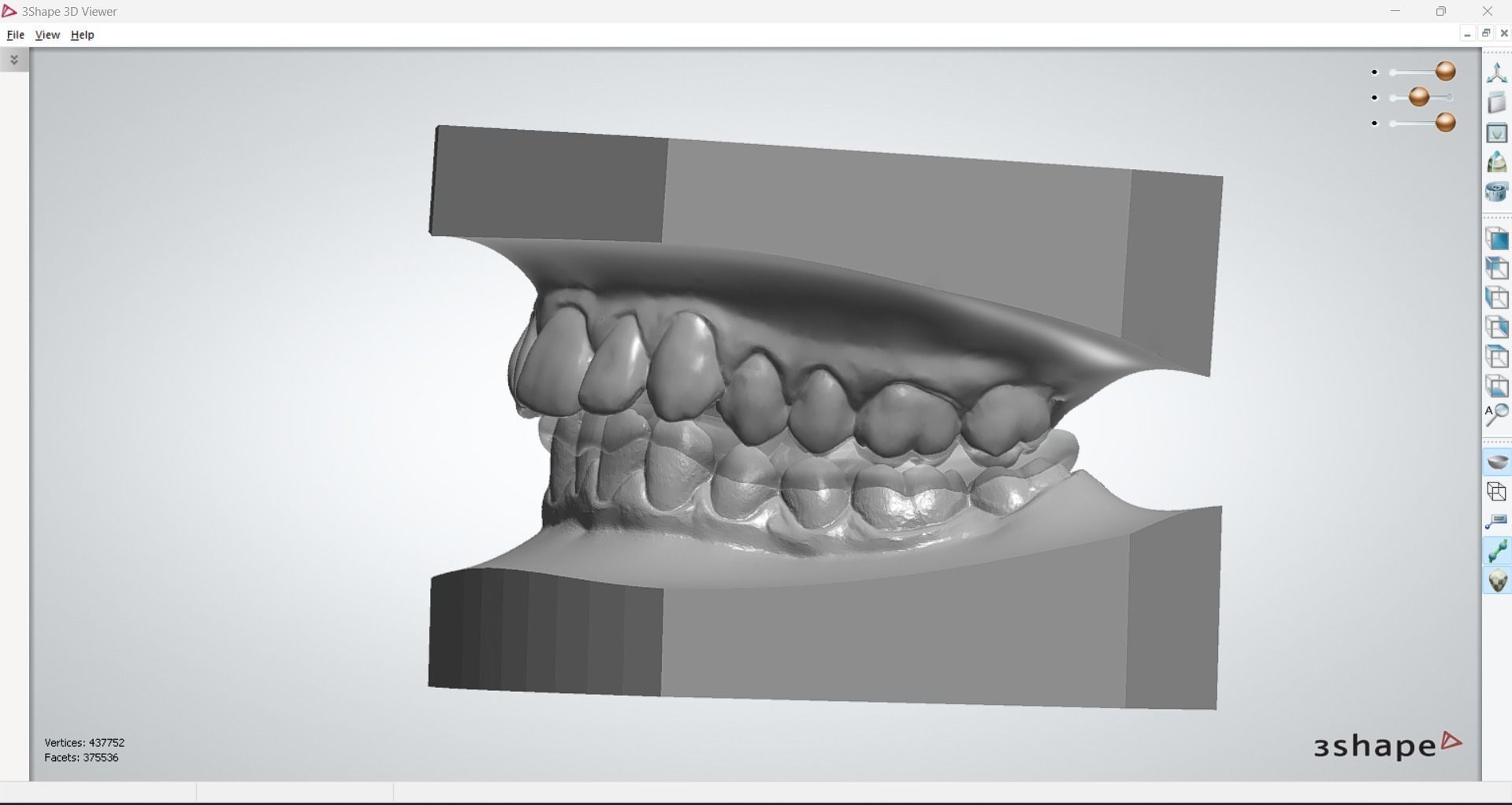 Digital Flat Occlusal Plane Splint 3D model 3D printable | CGTrader