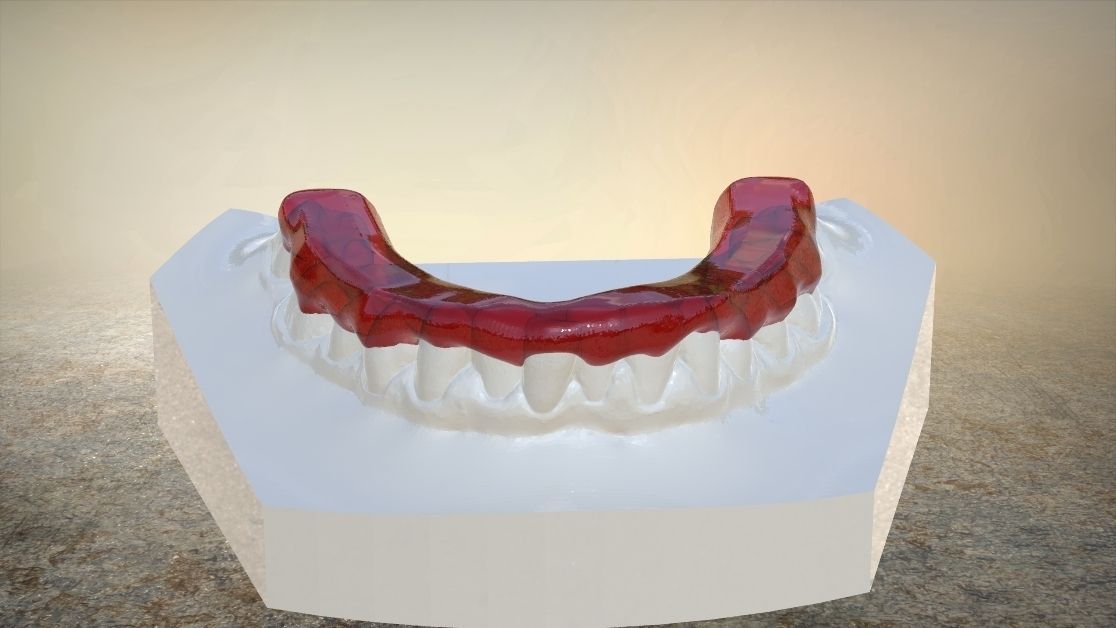 Digital Flat Occlusal Plane Splint 3D model 3D printable | CGTrader
