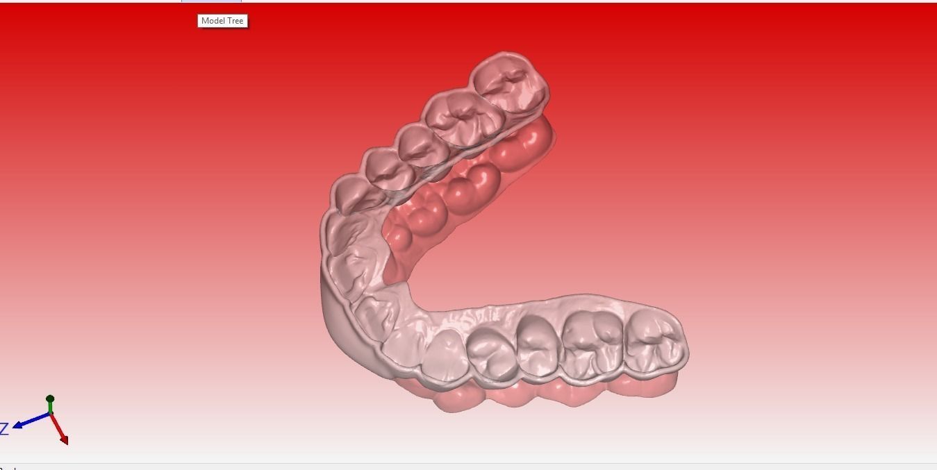 3D Dawson B Splints 3D model 3D printable | CGTrader