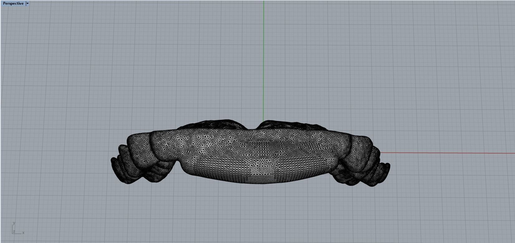 3D Dawson B Splints 3D model 3D printable | CGTrader