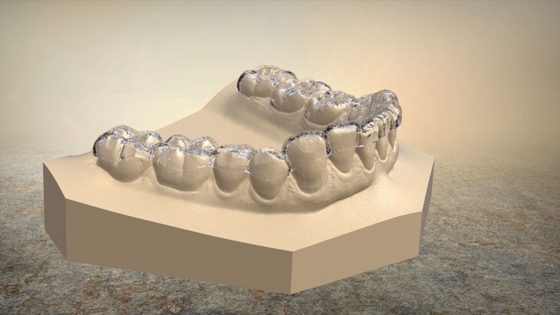 3D Dawson B Splints 3D model 3D printable | CGTrader