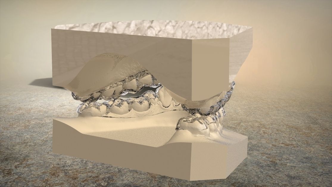 3D Dawson B Splints 3D model 3D printable | CGTrader