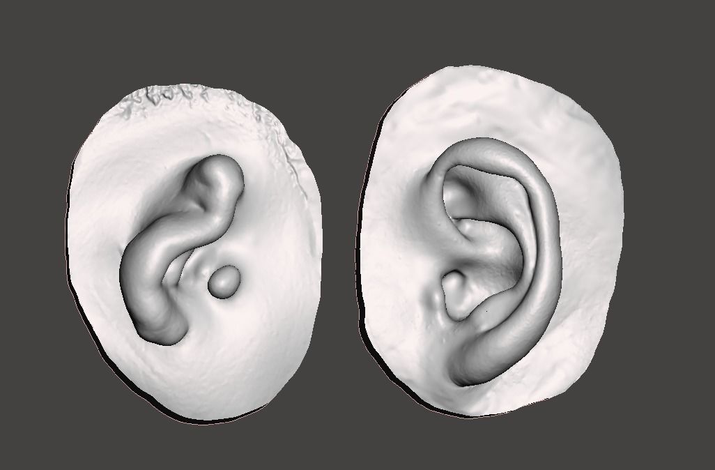Natural ear anatomy with microtia 3D model 3D printable | CGTrader