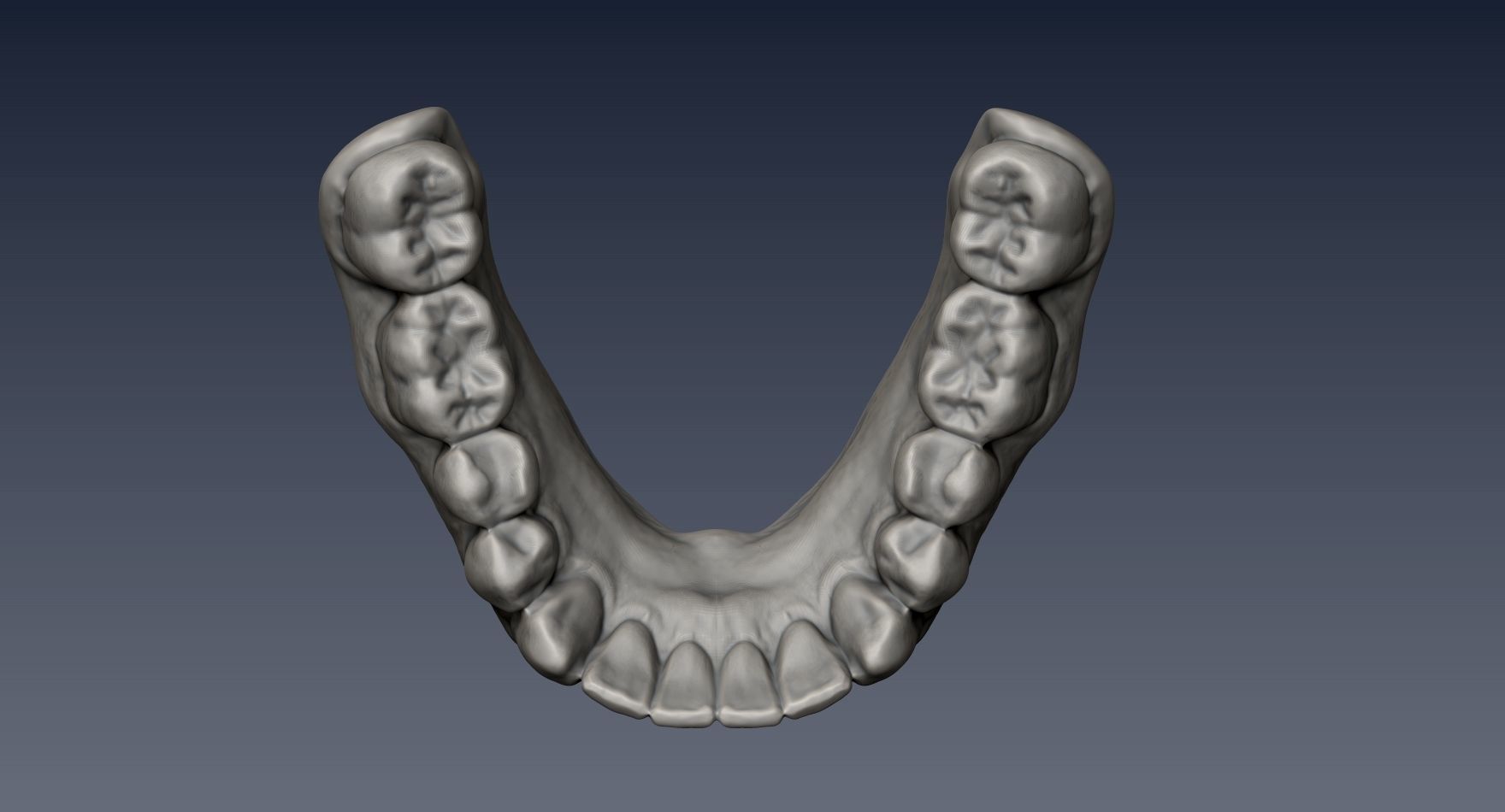 Real Teeth 3d scan for 3d print 3D model 3D printable | CGTrader
