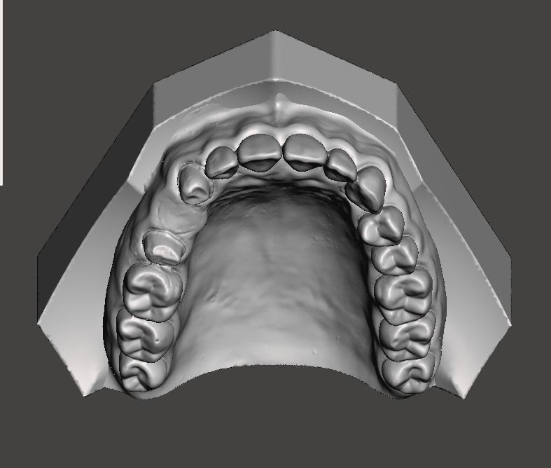 upper and lower ortho model bases 3D model 3D printable | CGTrader