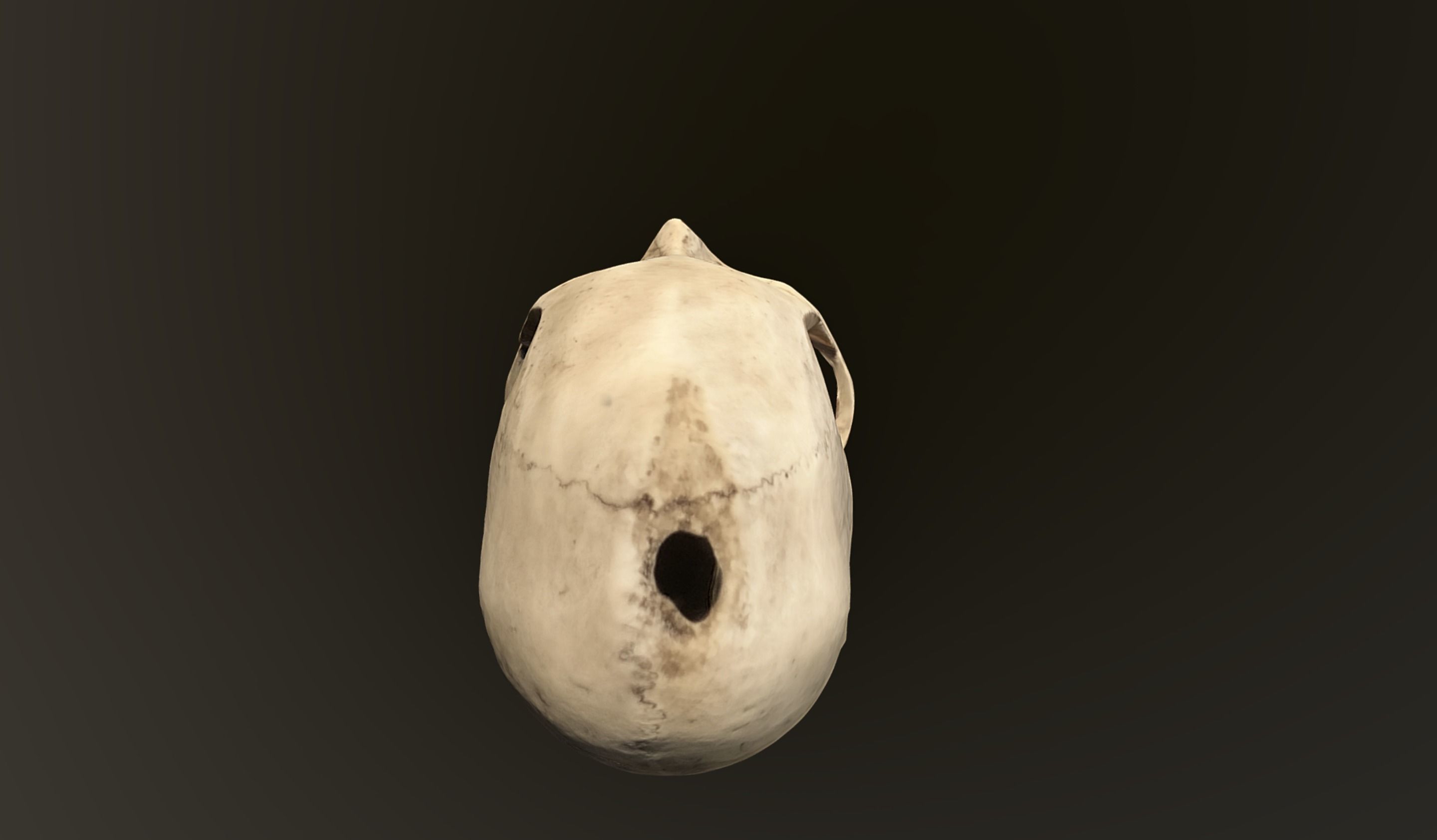 Human Skull Trepanation Photogrammetry 3D scan 3D model | CGTrader
