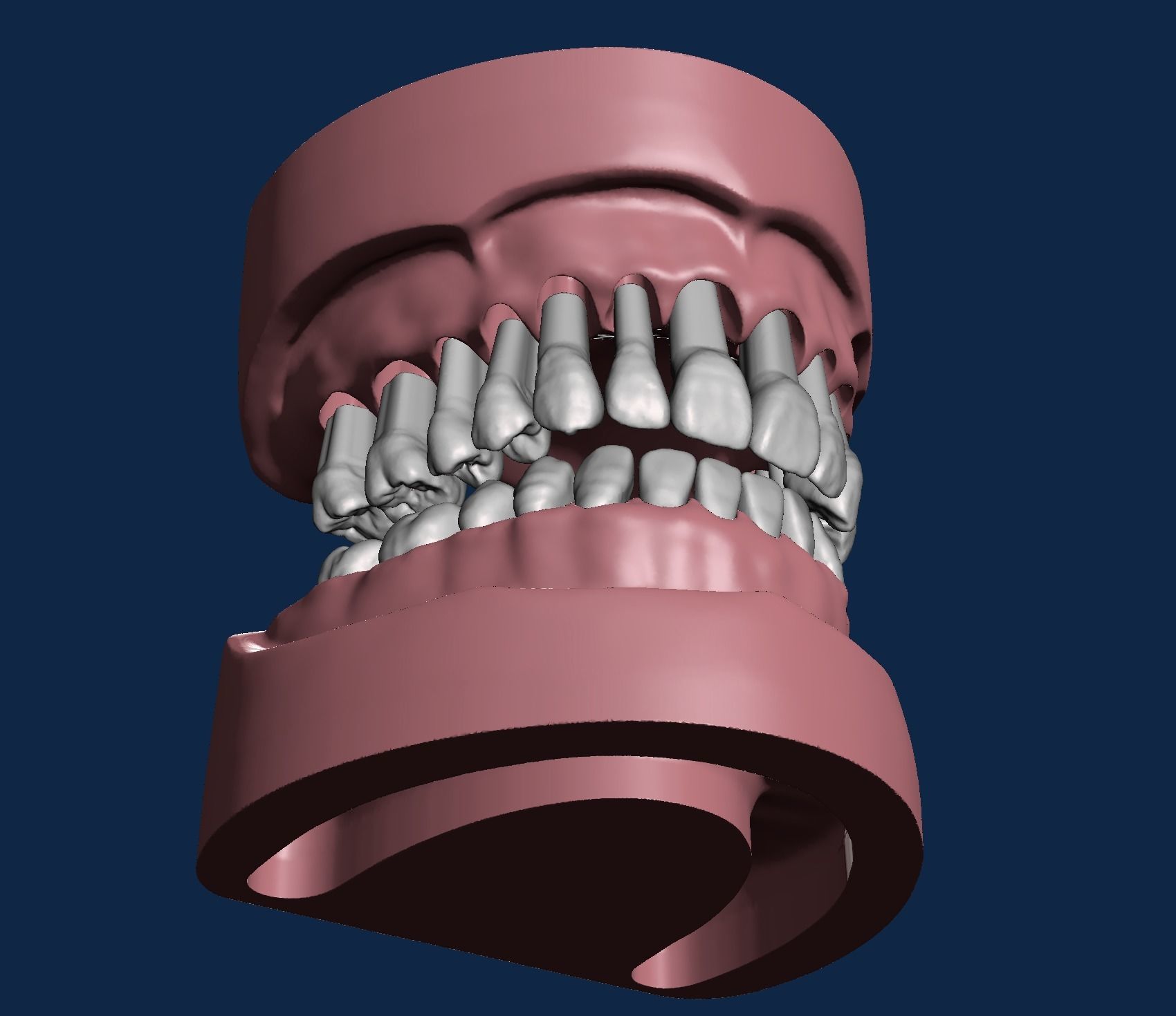 D003 Dental model with natural anatomy typodonts 3D model 3D printable ...