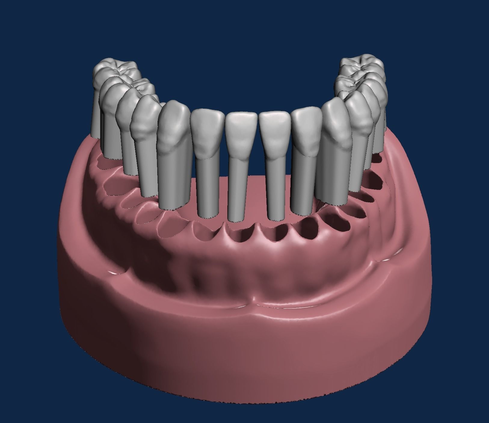 D003 Dental model with natural anatomy typodonts 3D model 3D printable ...