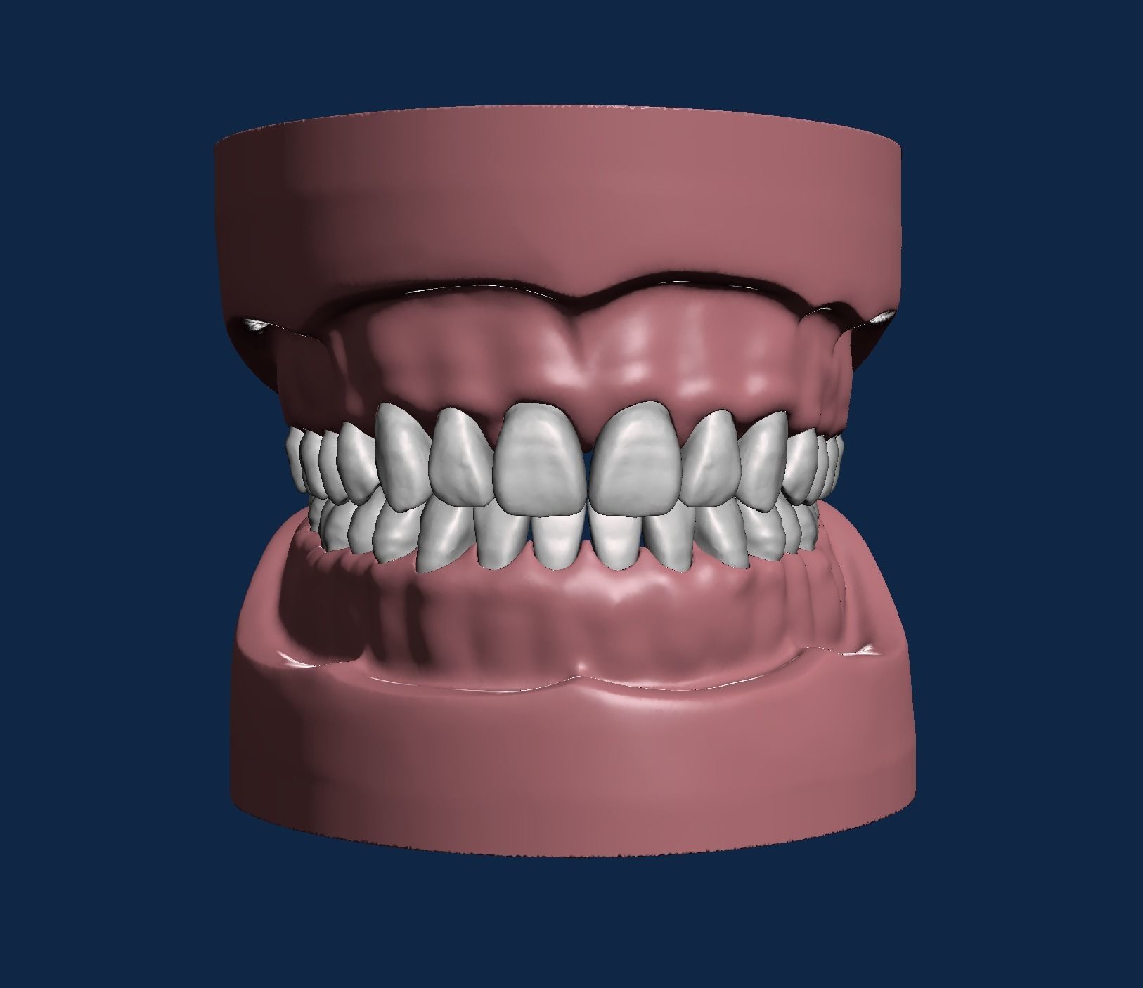 D003 Dental model with natural anatomy typodonts 3D model 3D printable ...