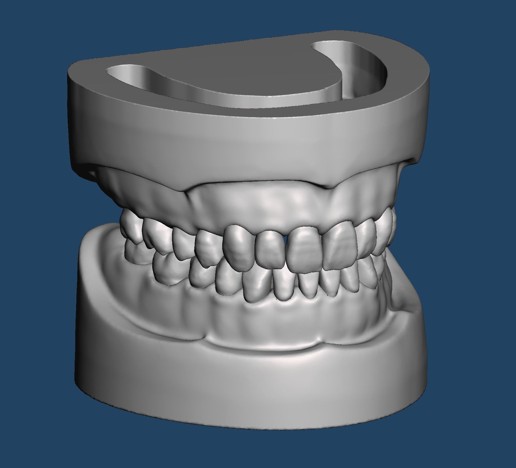 Dental Sample model 3D model 3D printable | CGTrader