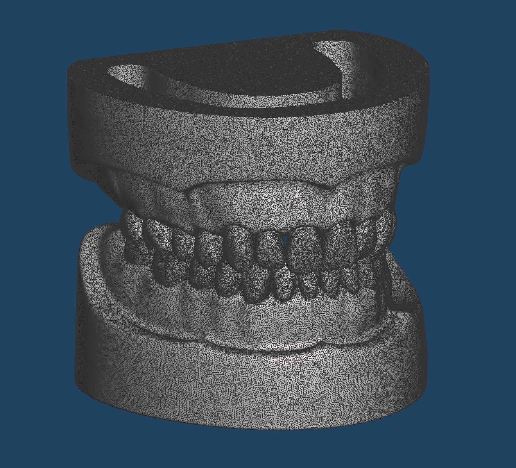 Dental Sample model 3D model 3D printable | CGTrader