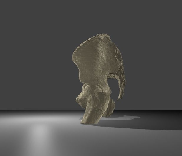 HUMAN HIP BONES FROM CT-SCAN 3D model | CGTrader