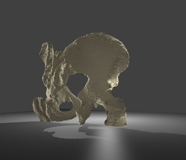 HUMAN HIP BONES FROM CT-SCAN 3D model | CGTrader