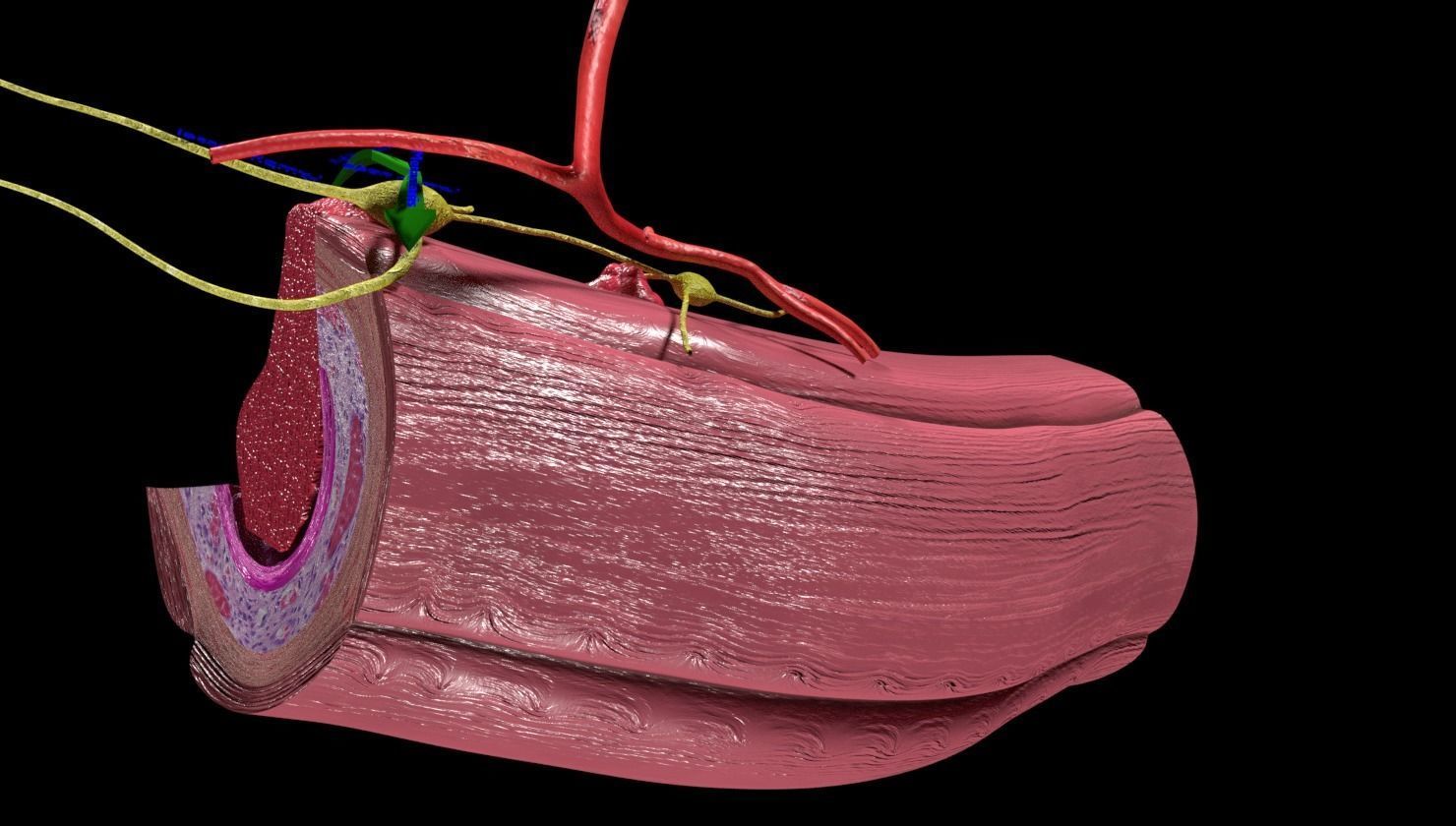 Colon cancer staging detail labelled 3D model | CGTrader