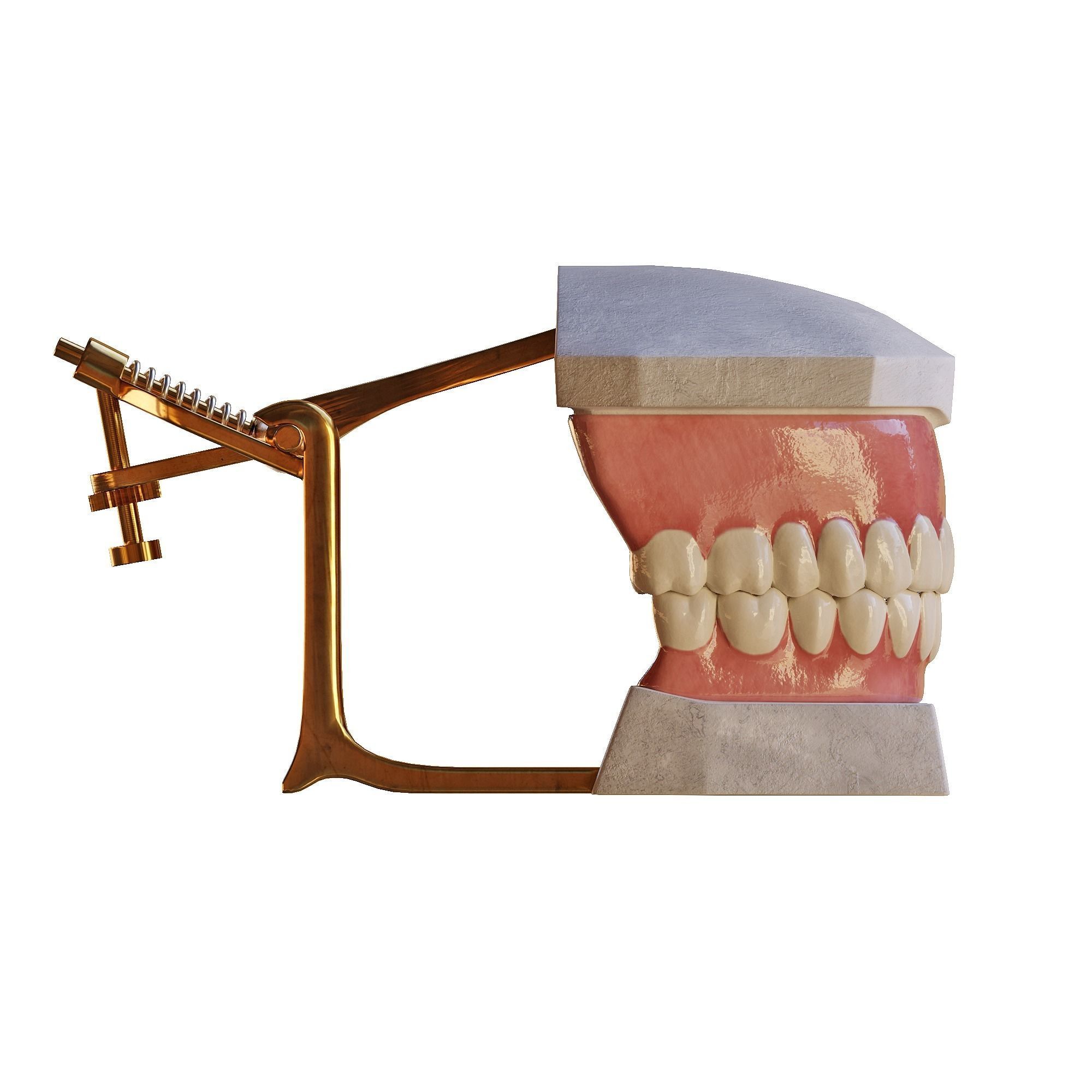 Dental Prosthesis 3D model animated | CGTrader