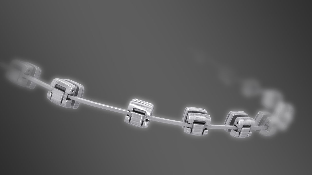 3D model Dental Braces VR / AR / low-poly | CGTrader