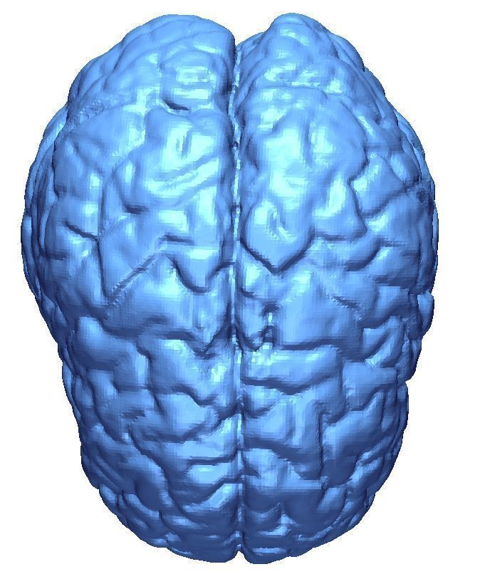 Human Brain 3D model from MRI DICOM - 3D model 3D printable | CGTrader