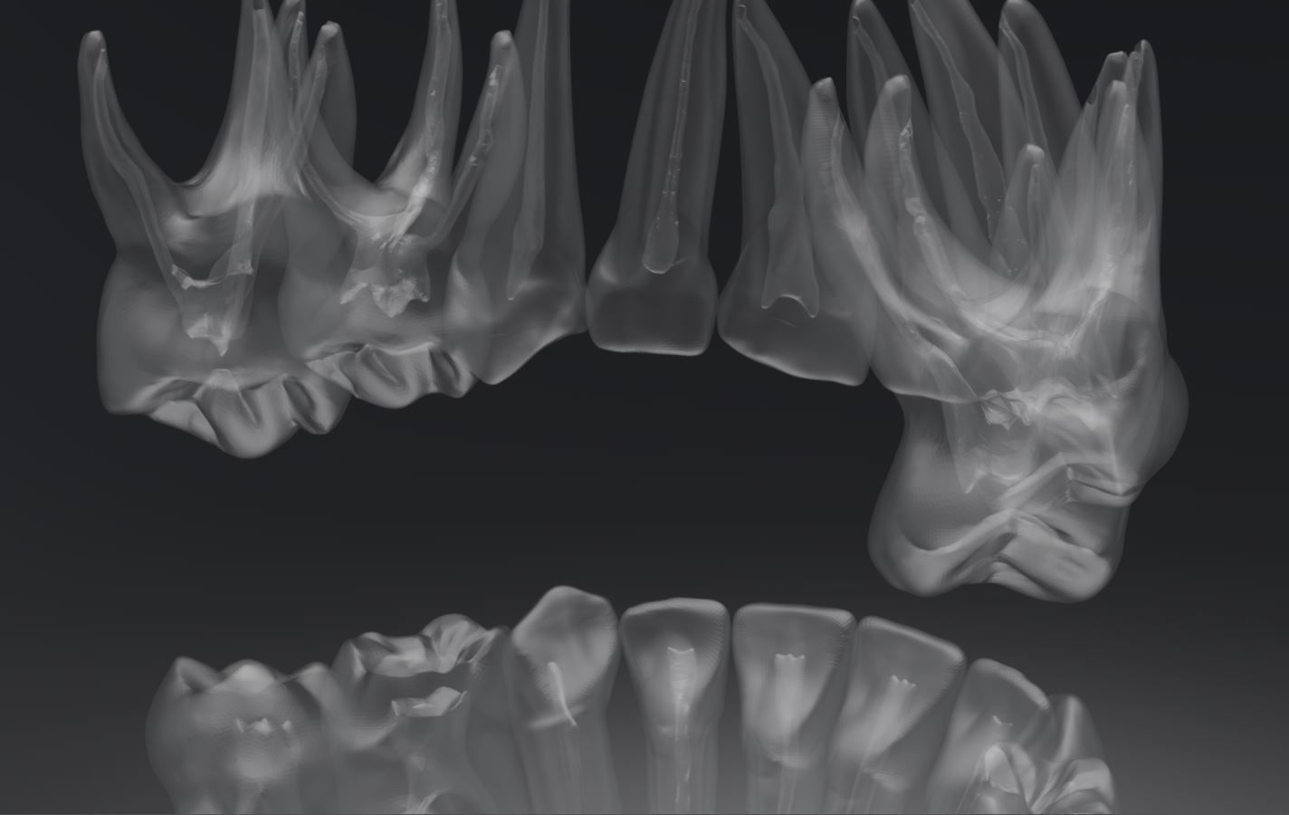 Primary Teeth with Pulp Cavity 3D model 3D printable | CGTrader