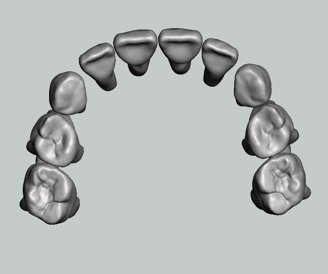 Primary teeth anatomy model 3D model 3D printable | CGTrader
