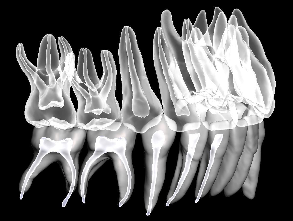 Primary teeth anatomy model 3D model 3D printable | CGTrader
