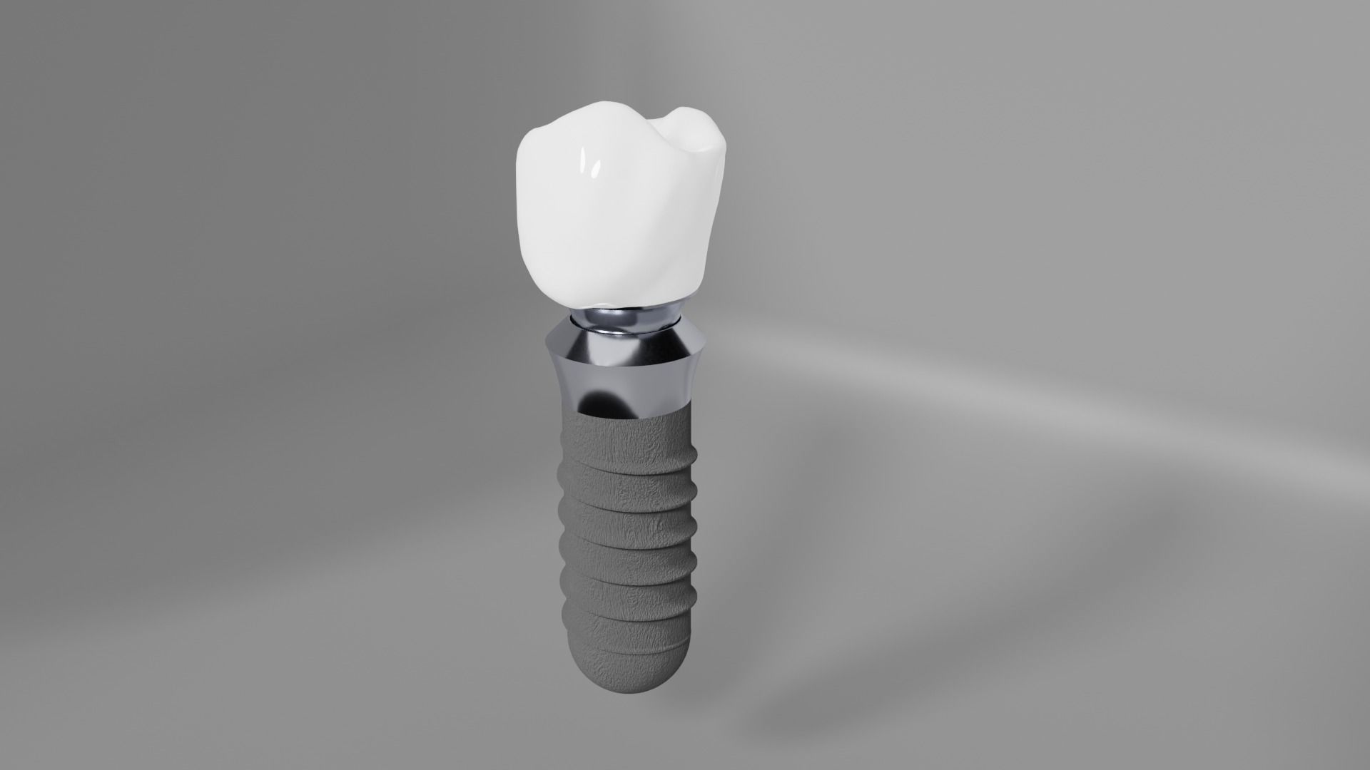 Dental implant crown restoration - High-res 3D model | CGTrader