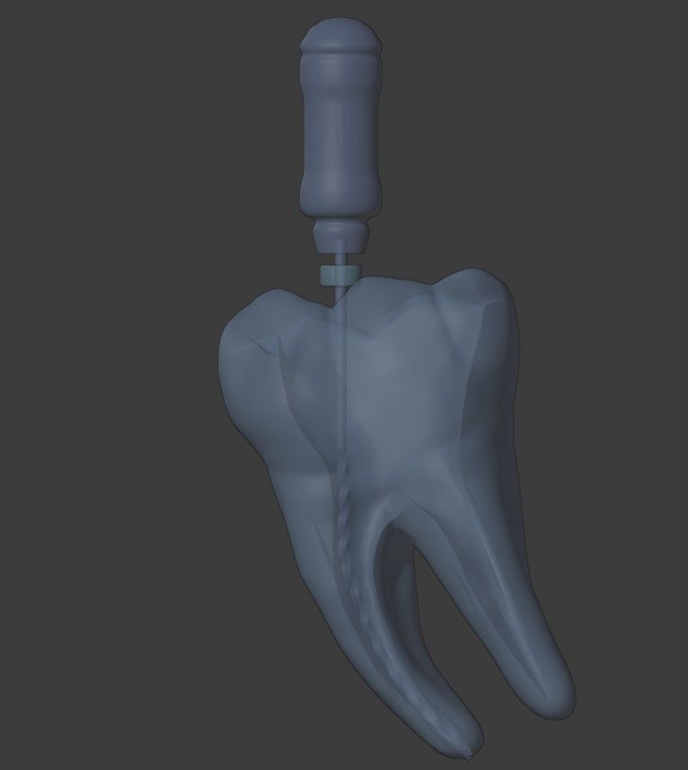 Molar and endodontic file 3D model | CGTrader