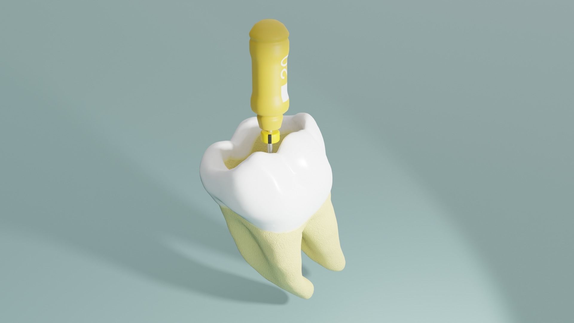 Molar and endodontic file 3D model | CGTrader