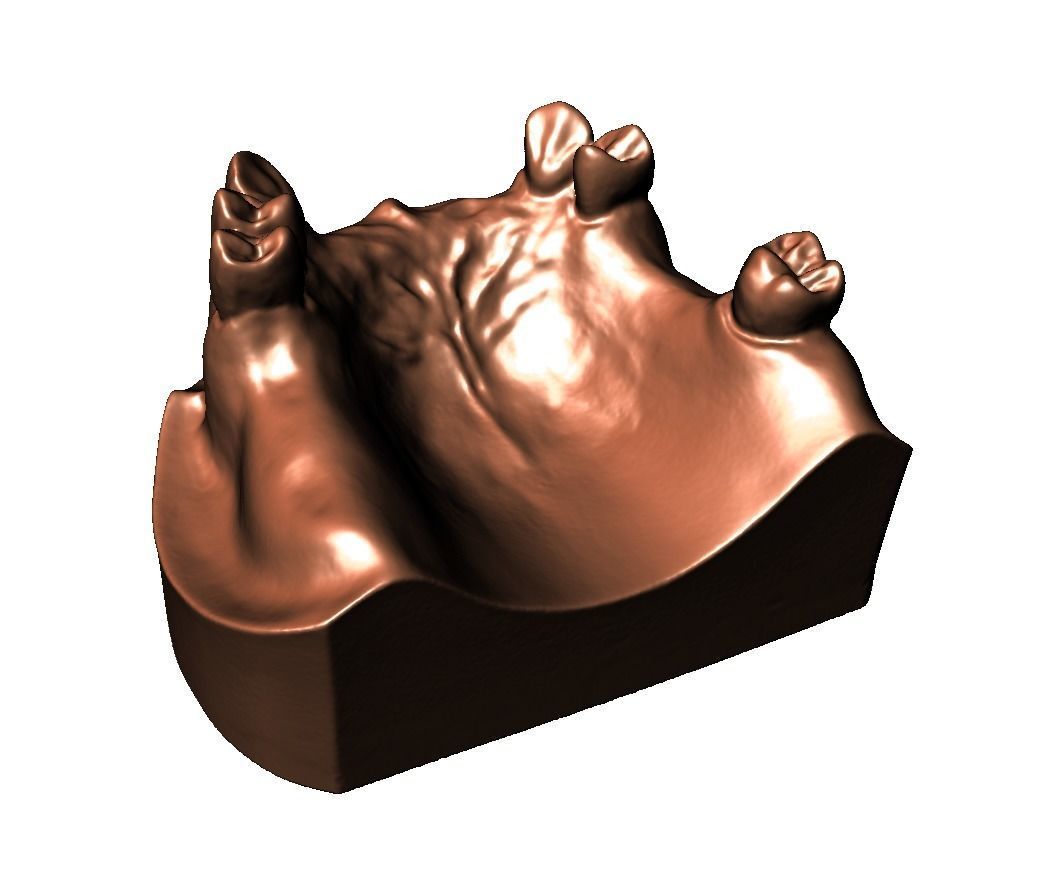 3D model Dental Model rpd cast upper lower VR / AR / low-poly | CGTrader