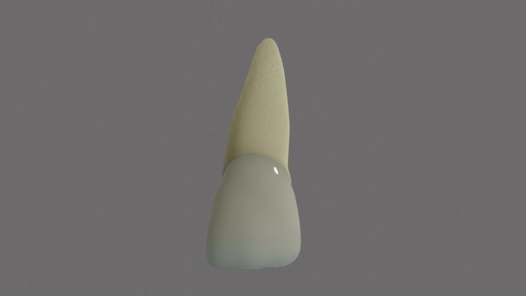 Fiber post and core with single crown - Anterior tooth 3D model | CGTrader