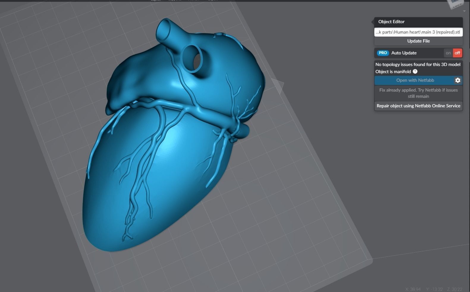 Human Heart Cross section 3D model 3D printable | CGTrader