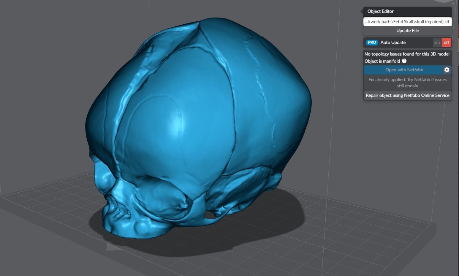Fetal Skull 3D model 3D printable | CGTrader