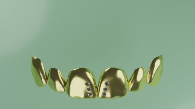 Grillz with diamonds in the front teeth 3D model | CGTrader