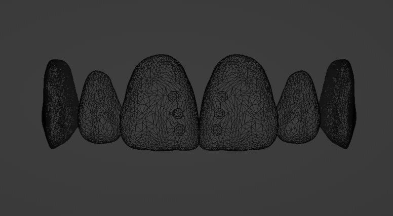 Grillz with diamonds in the front teeth 3D model | CGTrader