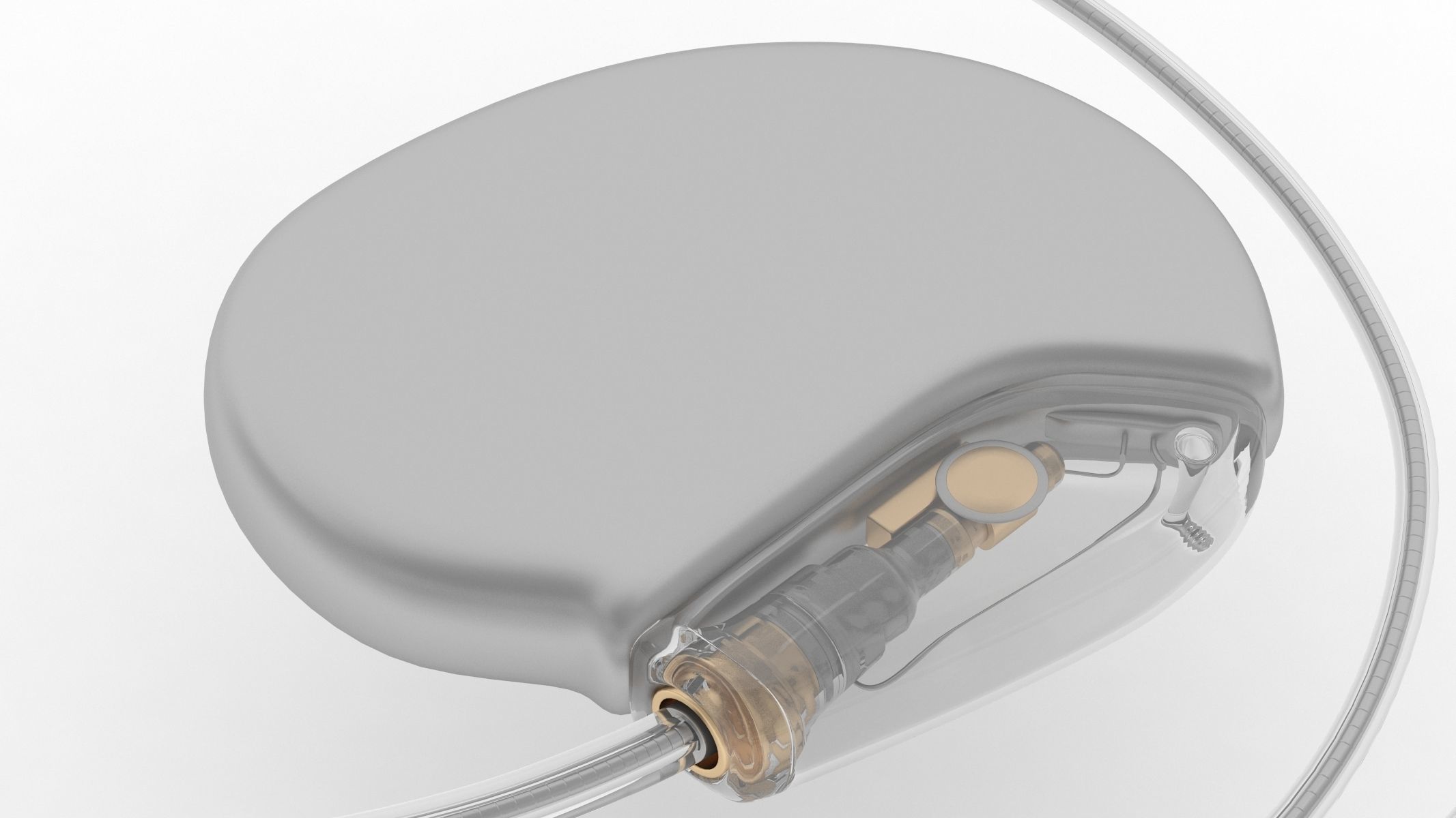 Pacemaker 3D model | CGTrader