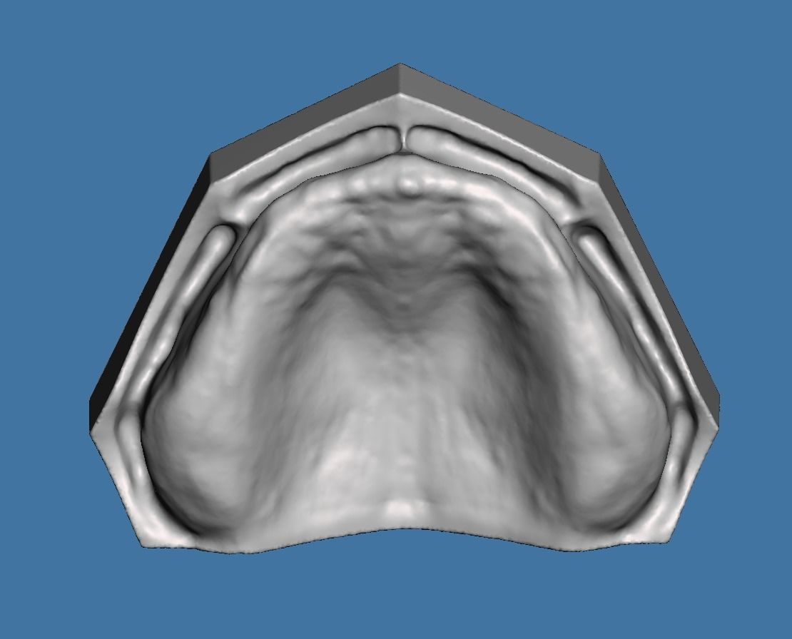 Edentulous scan model maxillary and mandibular 3D model 3D printable ...