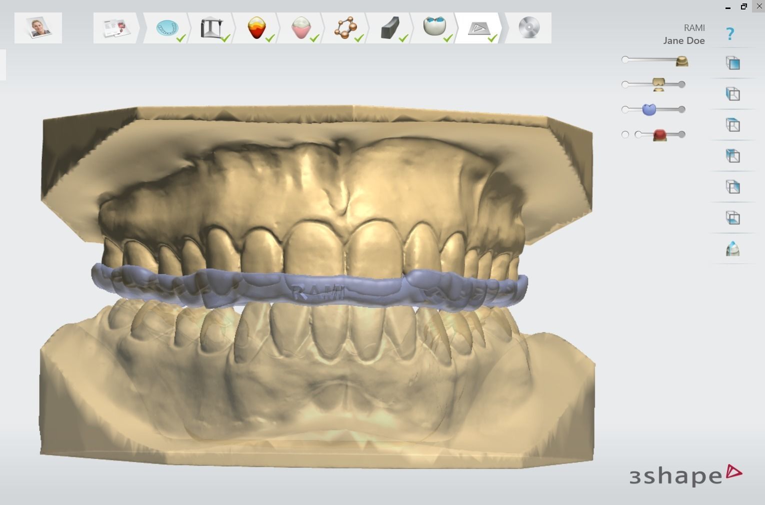 Full Coverage Occlusal Splint with Canine Guidance 3D model 3D ...