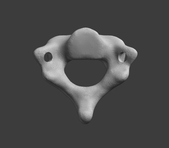 Axis C2 vertebra 3D model 3D printable | CGTrader