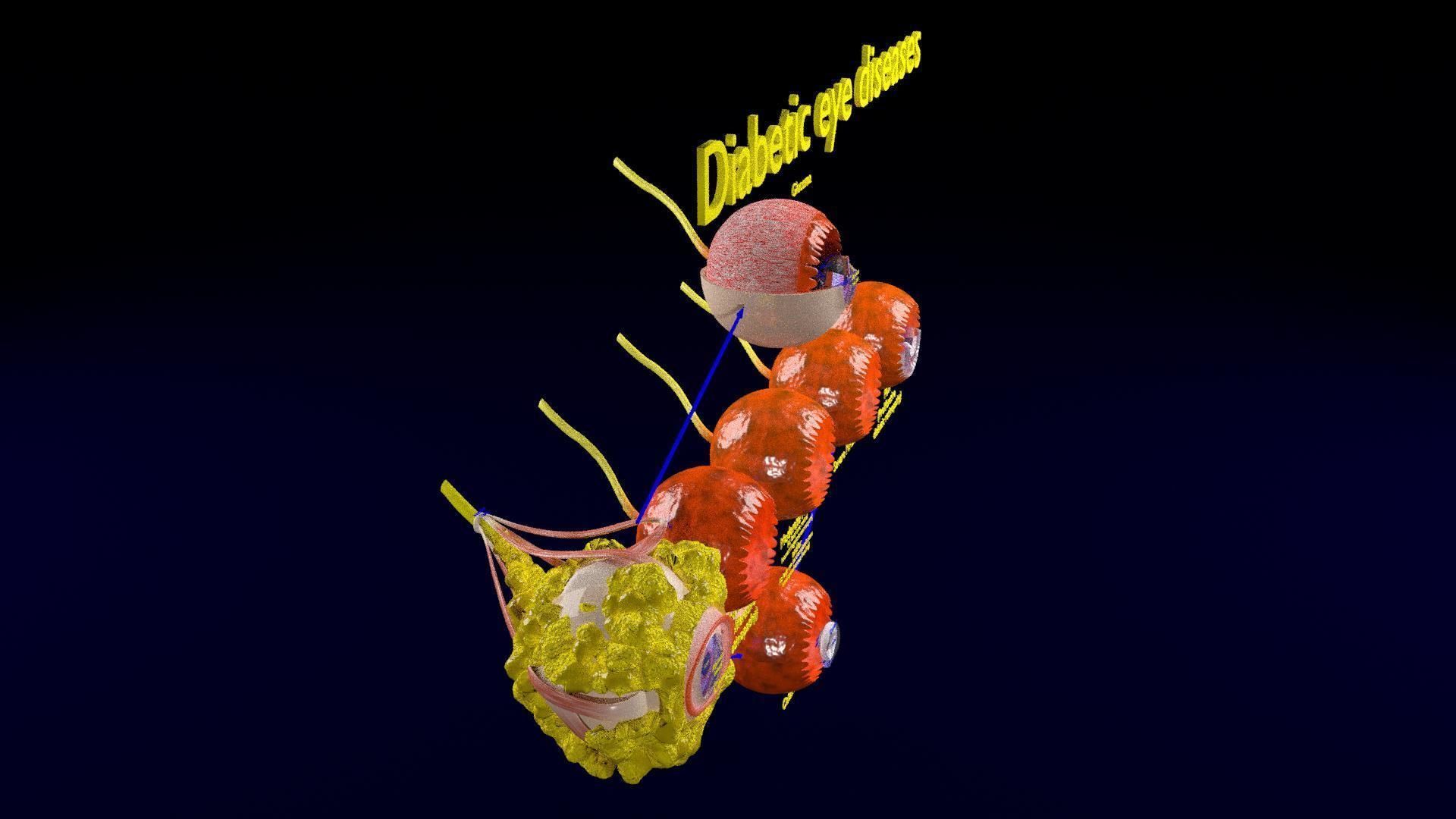 Diabetic eye diseases 3D model | CGTrader