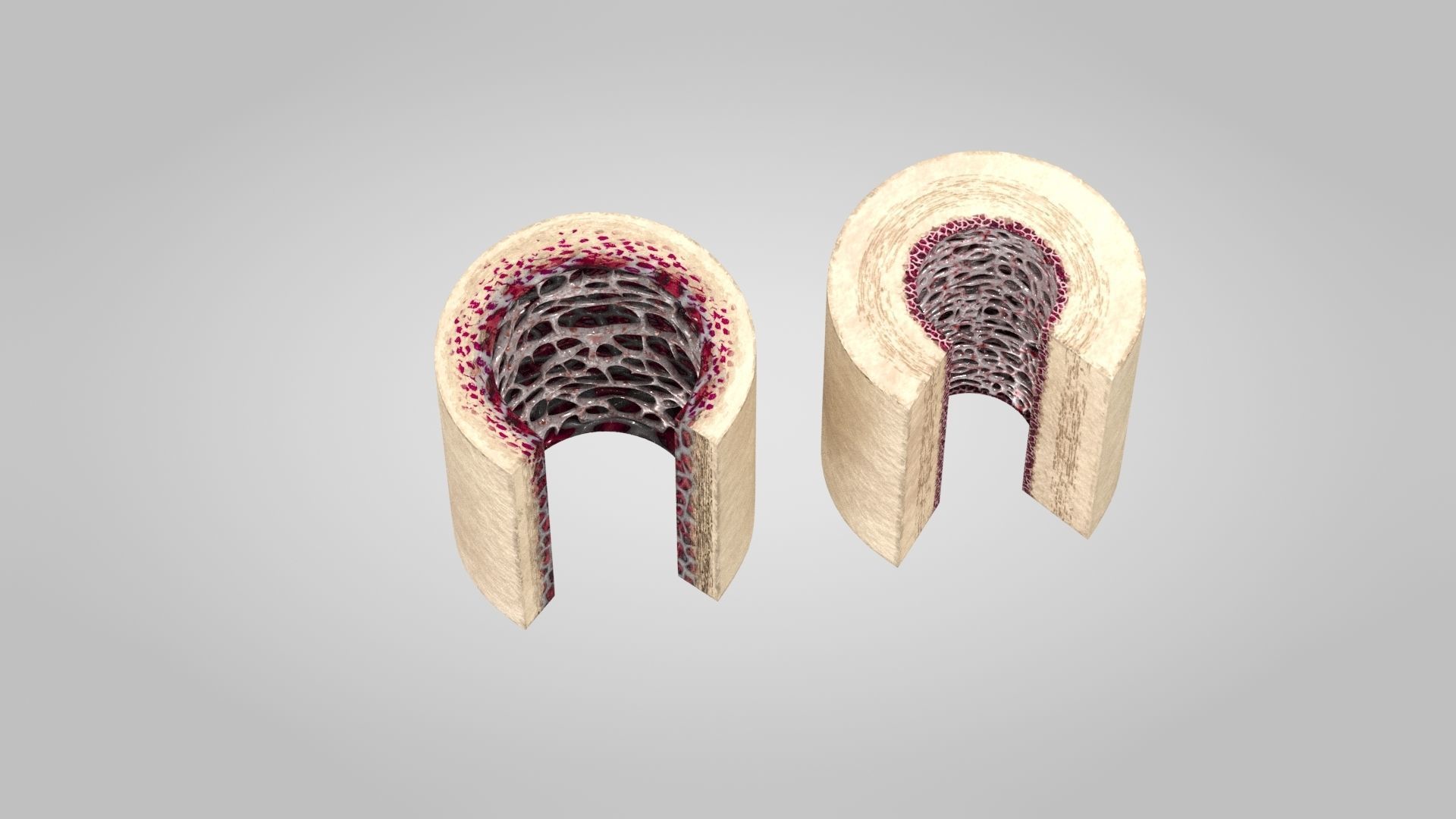 Healthy and Osteoporotic Bone Section 3D model | CGTrader