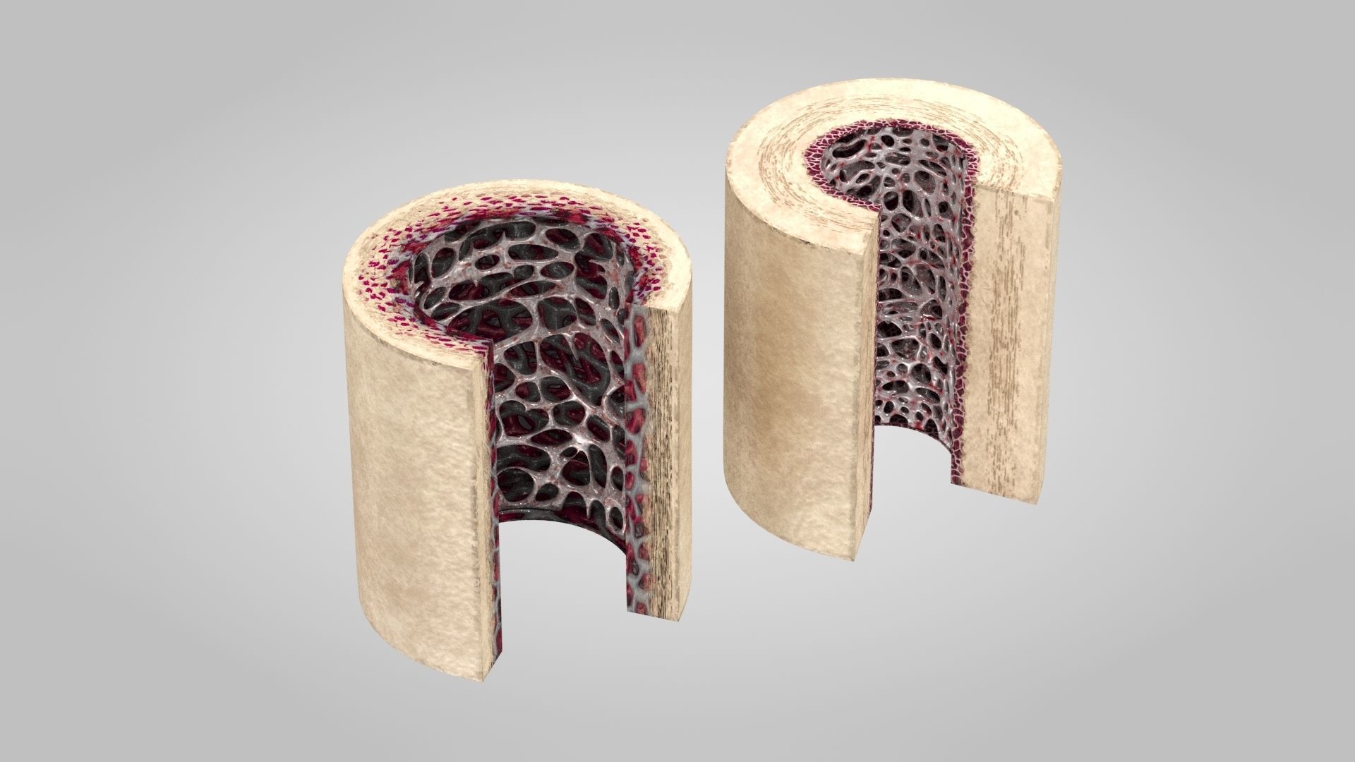 Healthy and Osteoporotic Bone Section 3D model | CGTrader