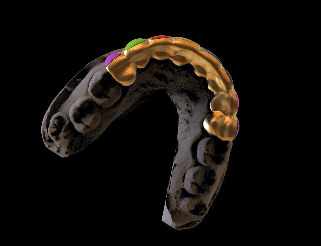 grillz rainbow colored grill on tooth 3D model 3D printable | CGTrader