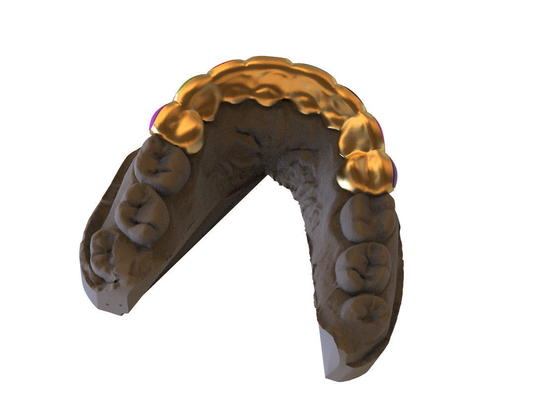 grillz rainbow colored grill on tooth 3D model 3D printable | CGTrader