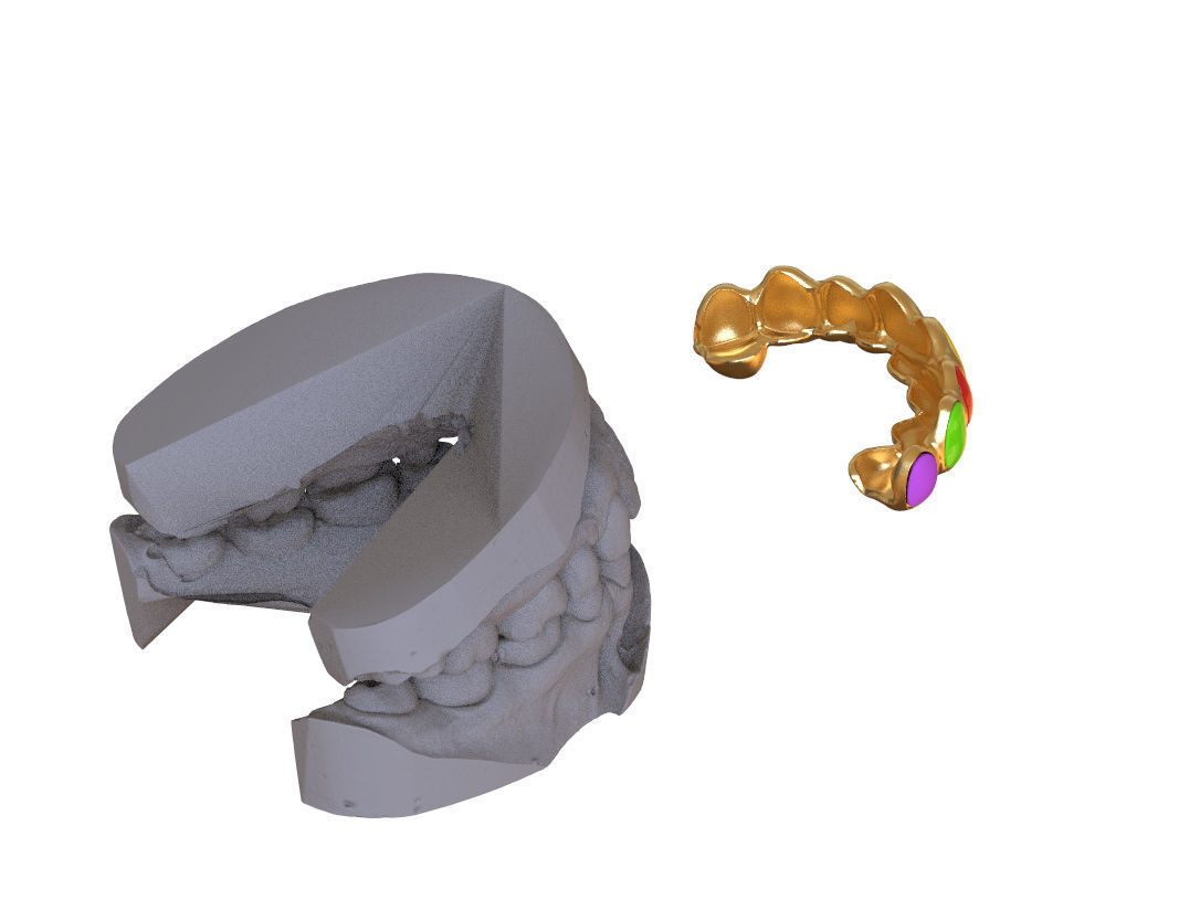 grillz rainbow colored grill on tooth 3D model 3D printable | CGTrader
