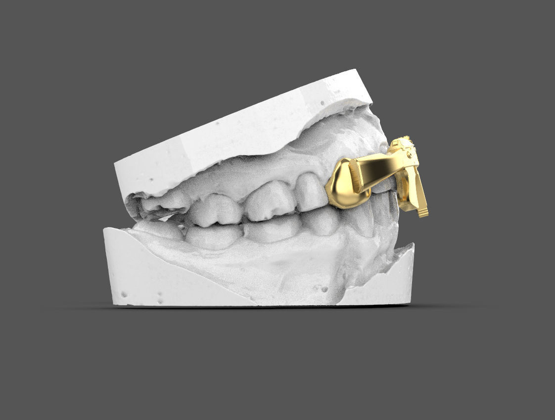 grillz gold brace with gun 3D model 3D printable | CGTrader