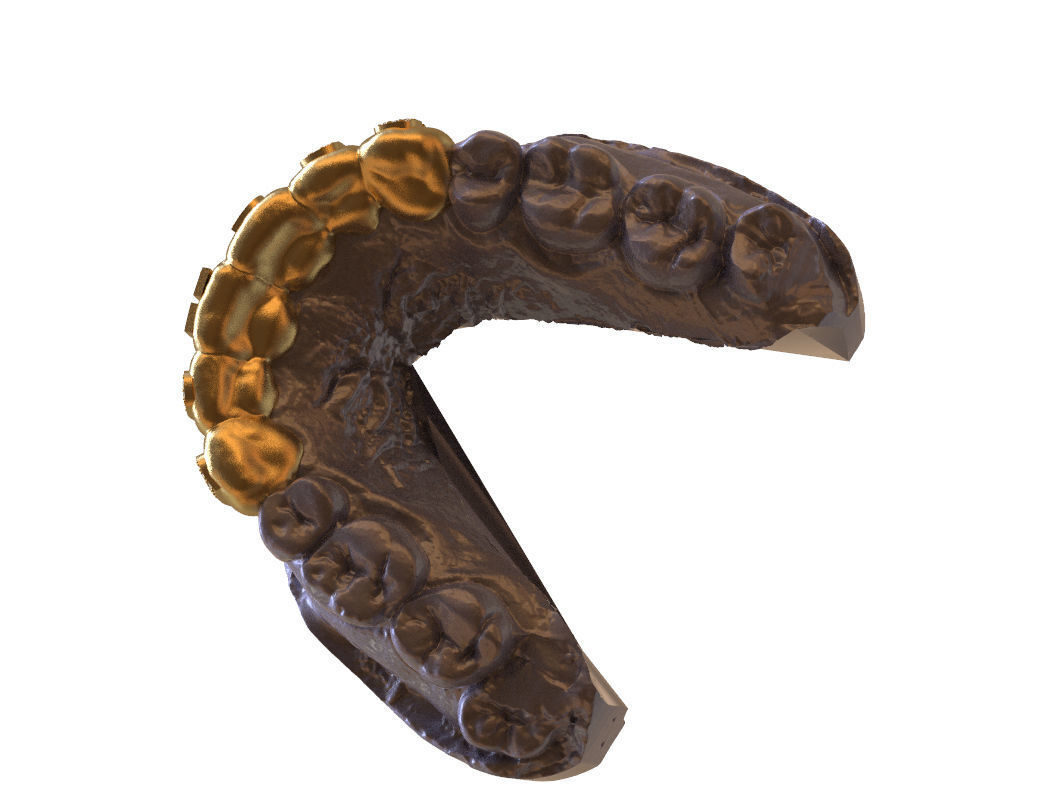grillz gold grill with diamonds 3D model 3D printable | CGTrader