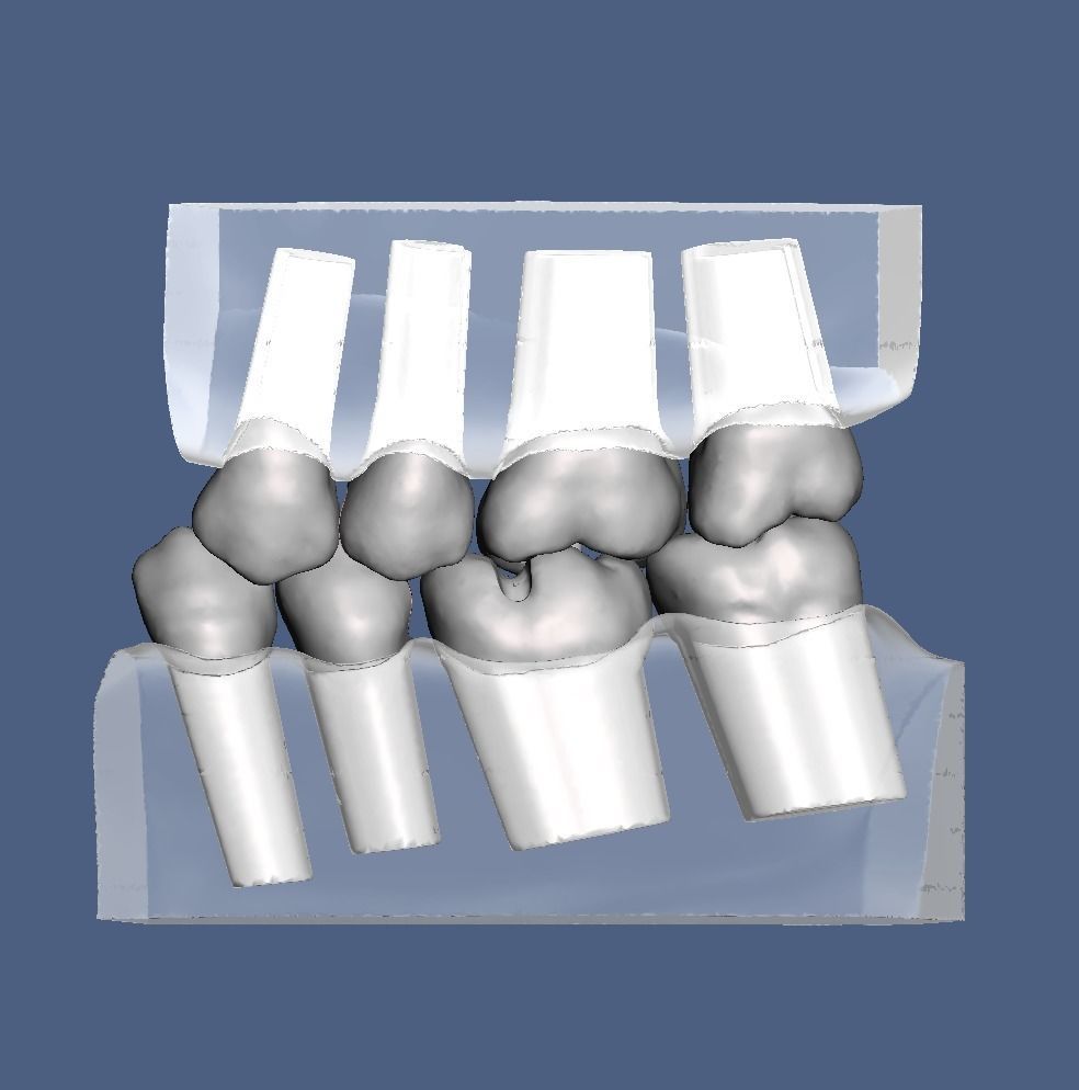 D004 Dental anatomy model Inlay Composite practice 3D model 3D ...