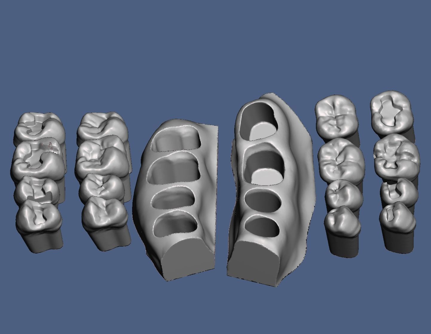 D004 Dental anatomy model Inlay Composite practice 3D model 3D ...