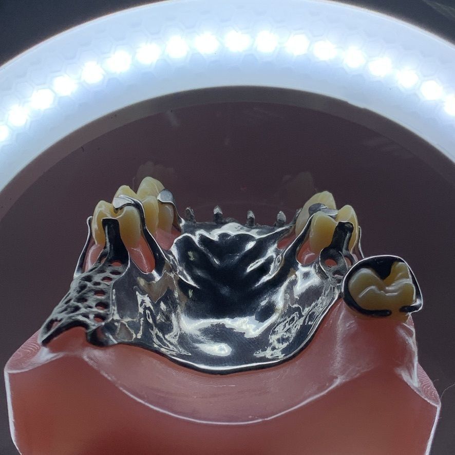 Metal framework RPD design 3D model 3D printable | CGTrader