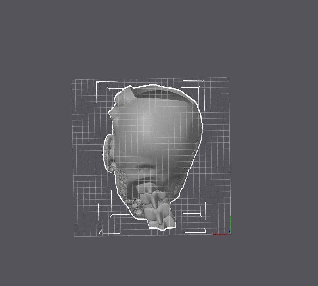 Zombie Head Candy Bowl 3D model 3D printable | CGTrader